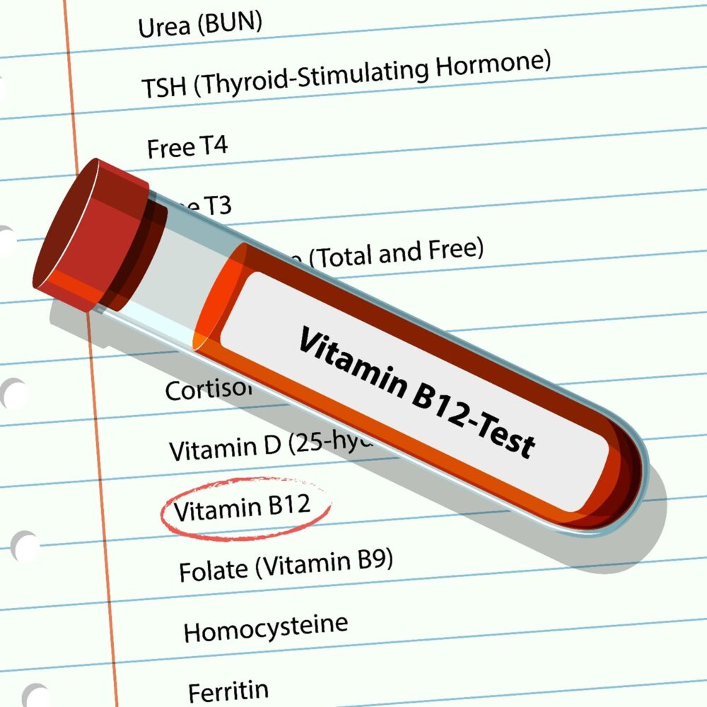 Vitamin B12 Test Made Easy – All You Need to Know ...